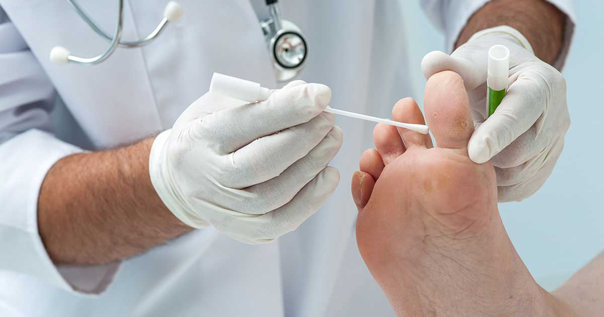 Ονυχομυκητίαση - Γεώργιος Κόκκαλης | Δερματολόγος - Αφροδισιολόγος